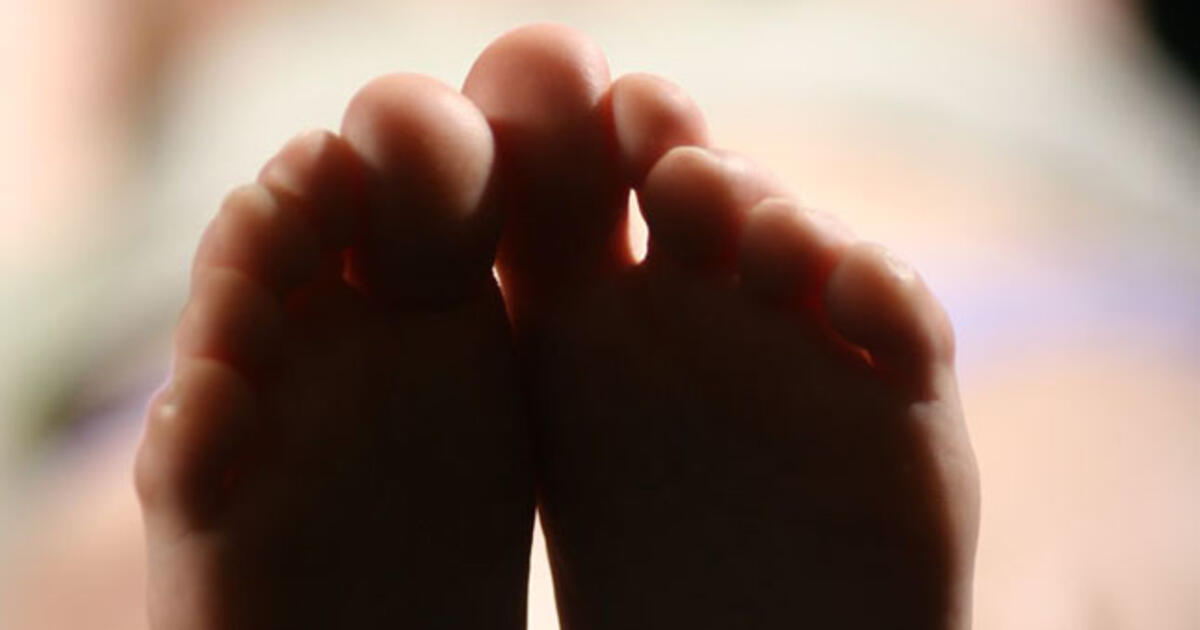 Nagų grybelis. Kaip išsigydyti?