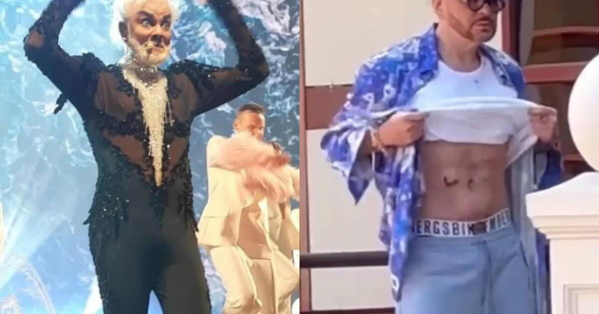 Nusiurbti riebalai grožio nepridėjo: chirurgas atskleidė supjaustyto ...