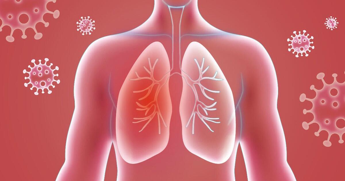 Pasaulyje pastebimi naujos pandemijos požymiai: ji gali būti blogesnė ...
