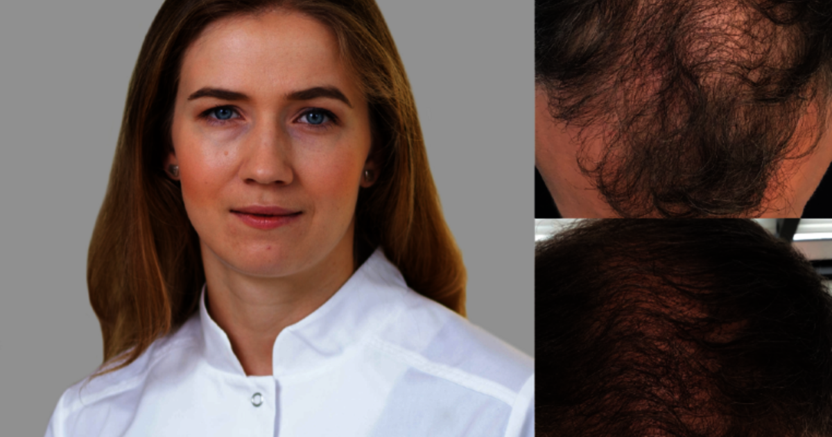 Gydytoja pataria: kaip prižiūrėti plaukus vasarą, kad išvengtume jų ...